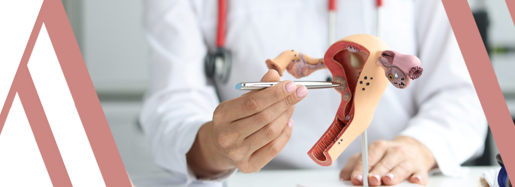 Vaginose Bacteriana: sintomas, causas, diagnóstico e tratamento